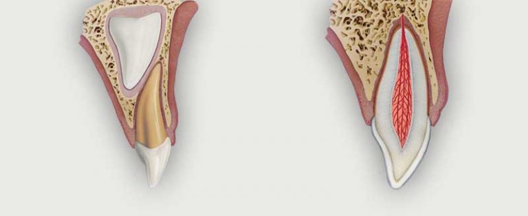 Trauma treatments – Dental Trauma Guide